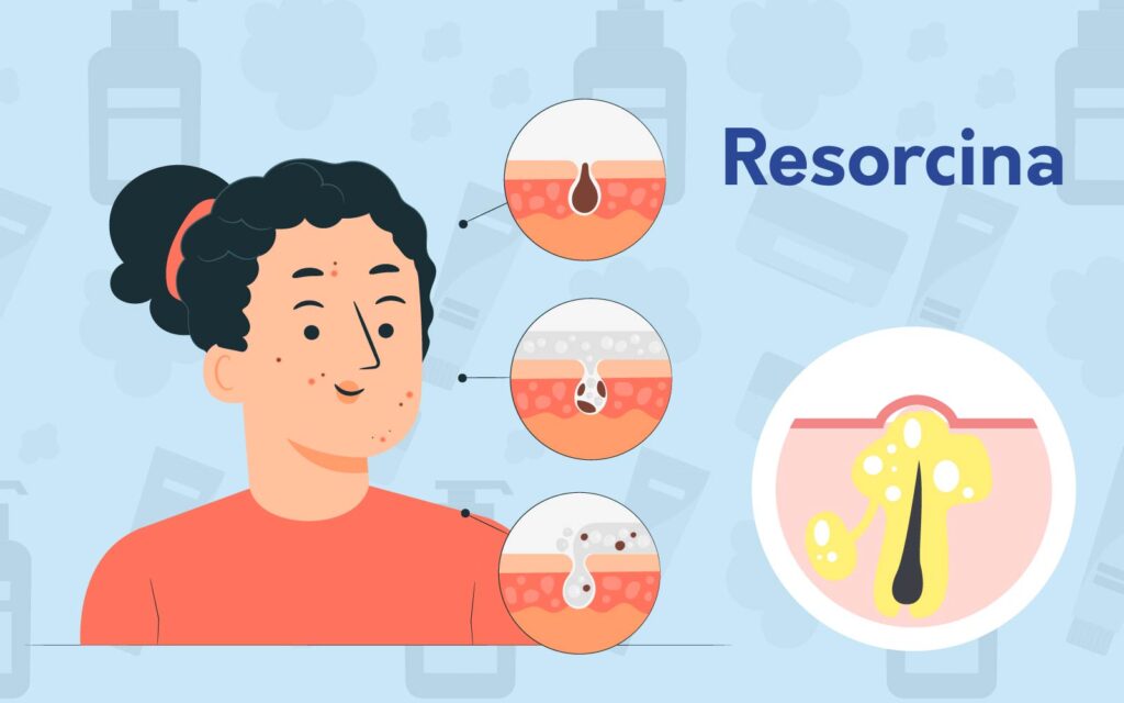 Usos de la Resorcina – Droguería Tacuba